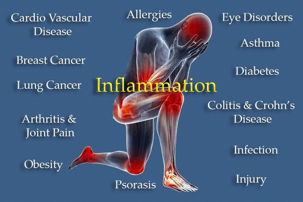 Flamasil® for Inflammation & More